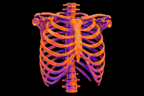 The 5 Biggest Opportunities for Innovation in Orthopaedics - Franklyn ...